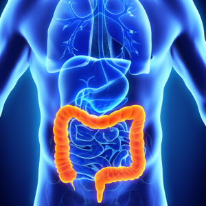 Sigmoid Colon Surgery FAQ - Newton Wellesley Surgeons